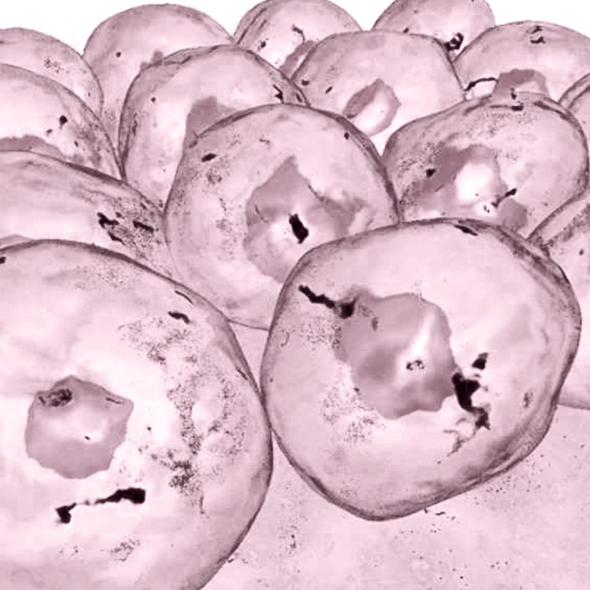 Stem Cell Therapy for Scleroderma | Stemaid Institute